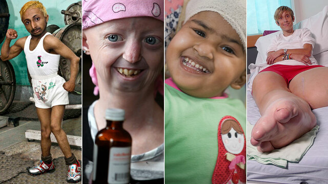 Extraordinary People - Channel 5